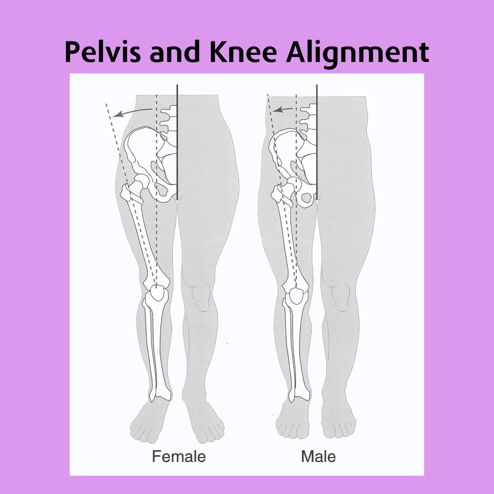 Common Sporting Injuries in Women | Pathways Physiotherapy ...